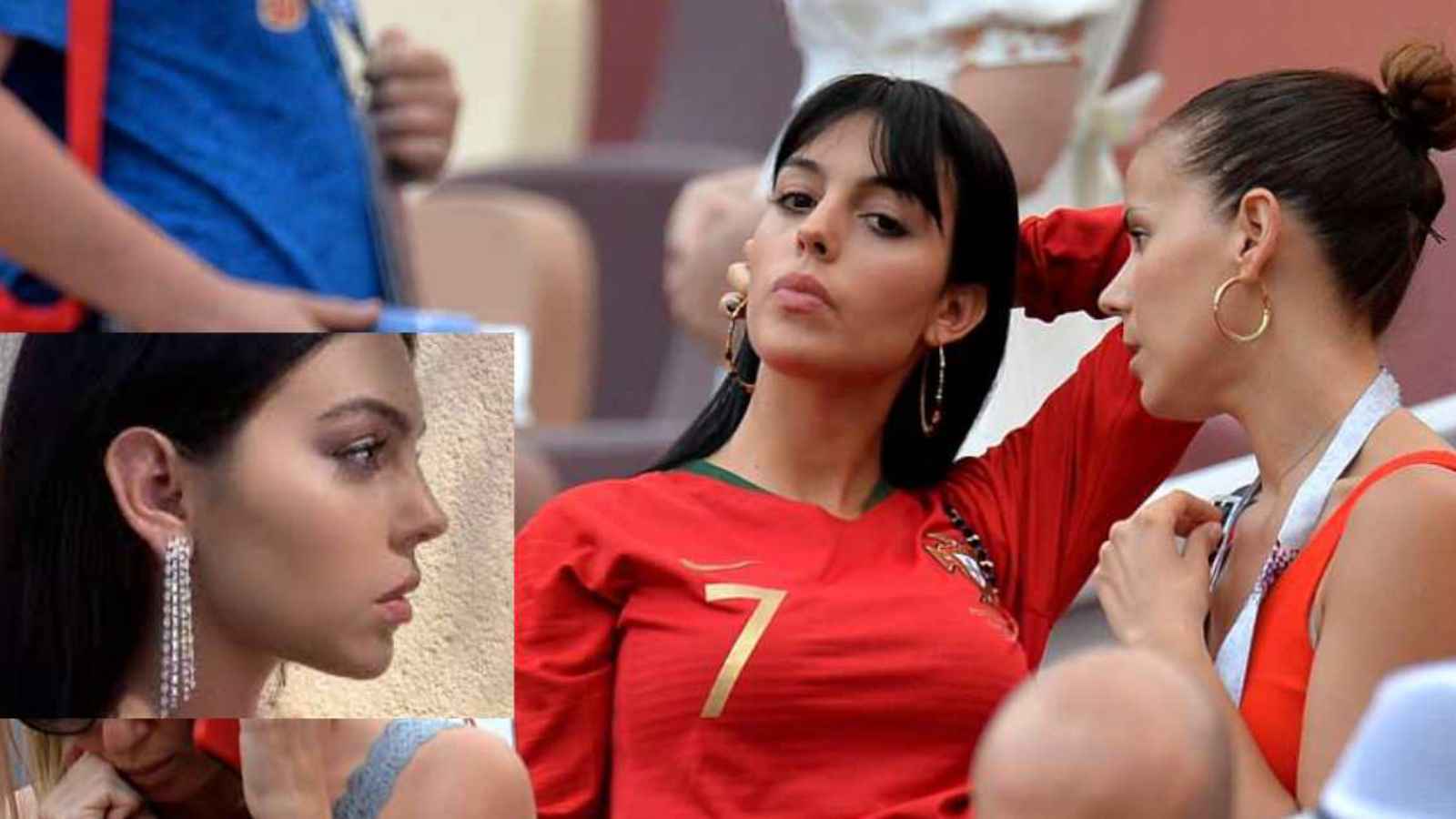 Cristiano Ronaldo Nose Job