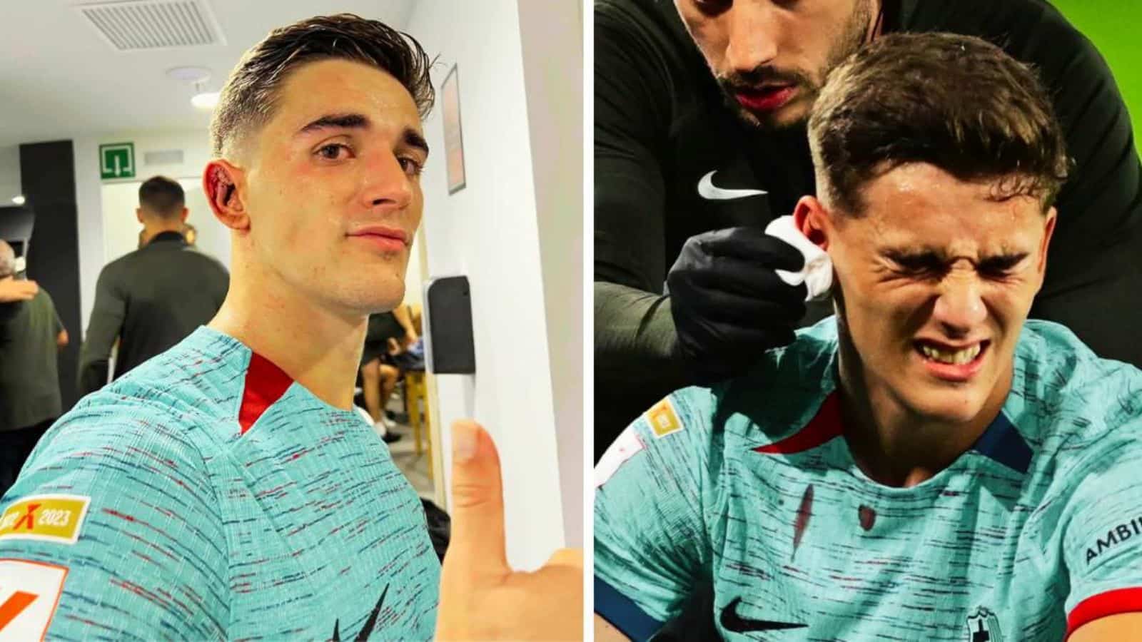 Gavis Ear: What Happened To Him? The Game Changing Moment! - Eduvast.com