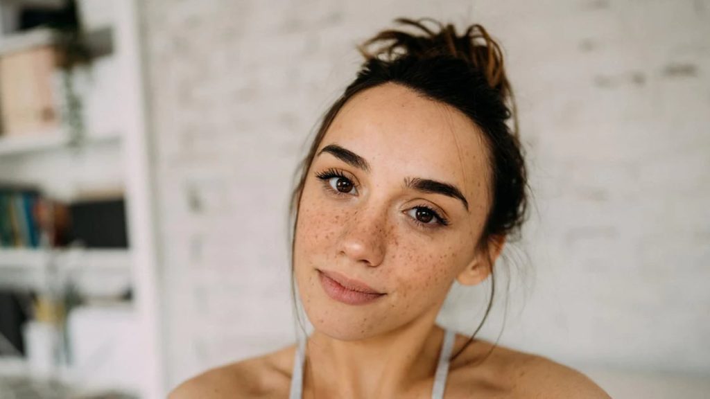 Love Your Freckles Day 2023: Date, History, Importance, 5 Facts About ...