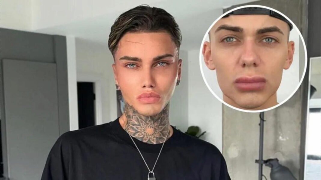 Levi Jed Murphy Plastic Surgery: Transformation Journey on TikTok ...